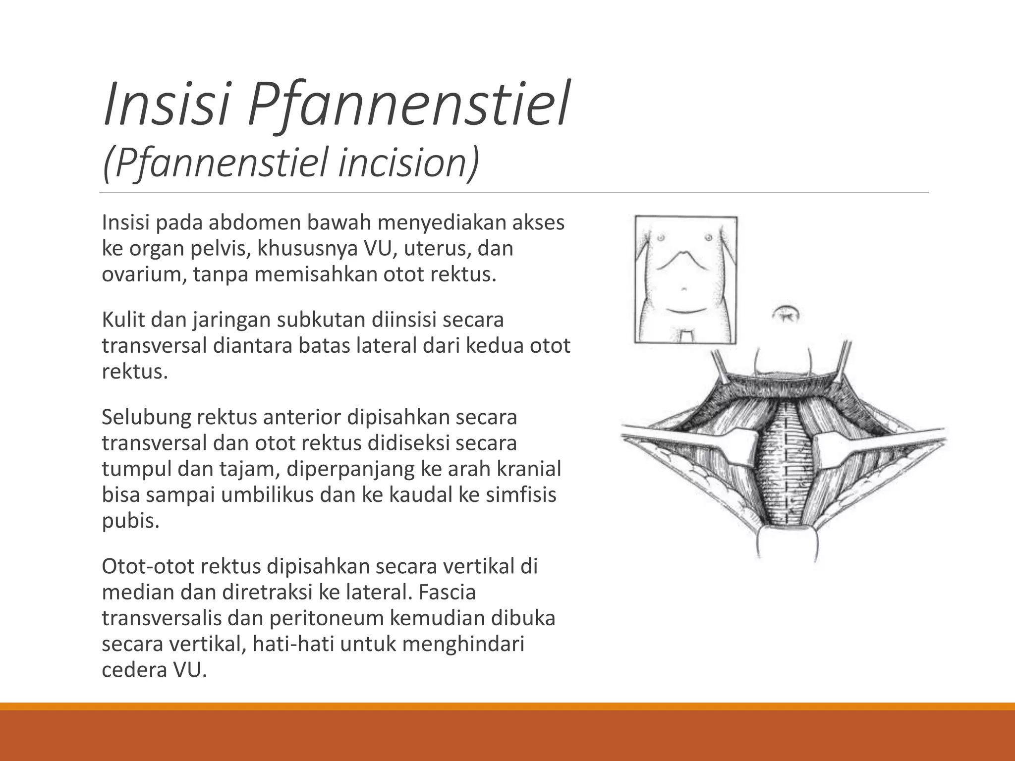 Insisi abdomen pada anak | PPTX