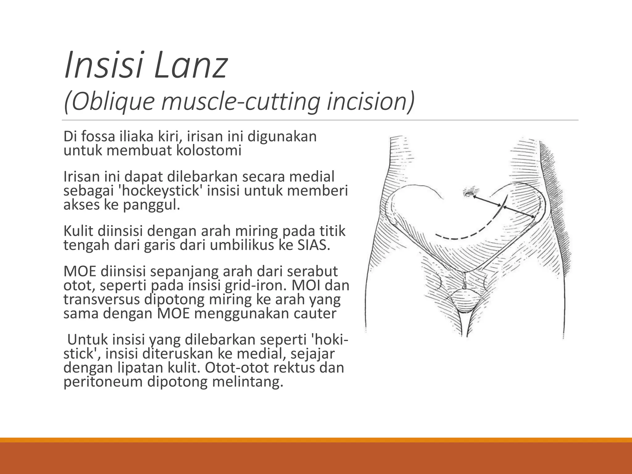 Insisi abdomen pada anak | PPTX
