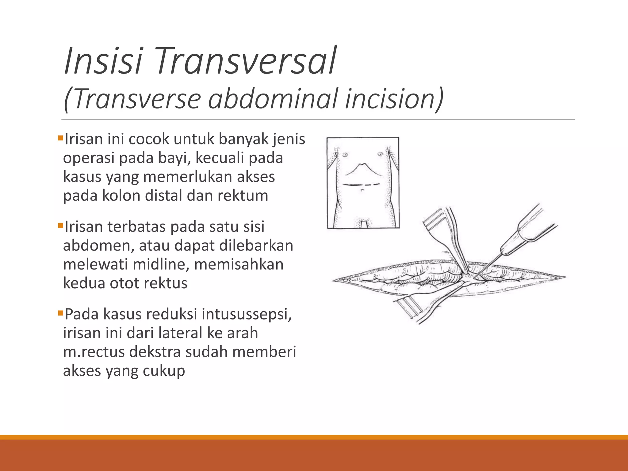 Insisi abdomen pada anak | PPTX