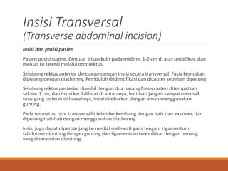 Insisi abdomen pada anak | PPTX