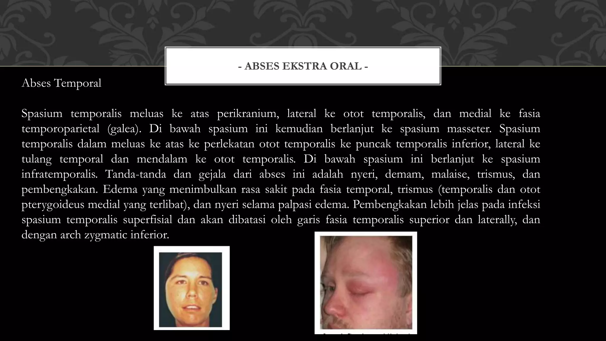 INSISI ABSES drg.Harijadi .pptx