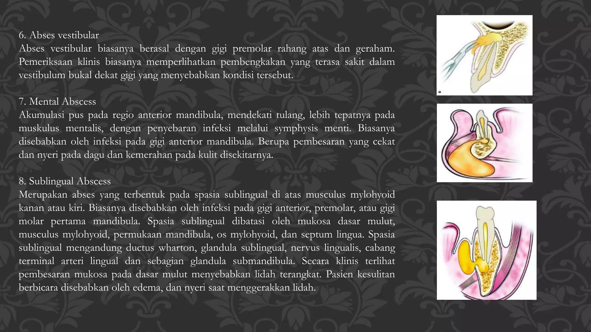 INSISI ABSES drg.Harijadi .pptx