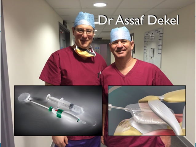 InSpace balloon for massive rotator cuff tears 2017 | PPT