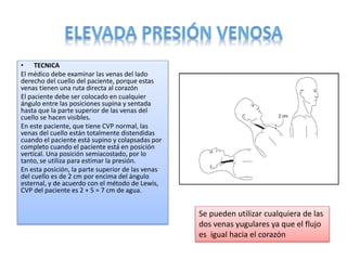 Inspección de las venas del cuello | PPTX