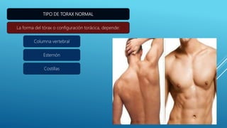 Inspeccion de torax | PPTX