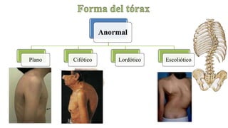 Inspección del Tórax. Semiología caja torácica | PPTX