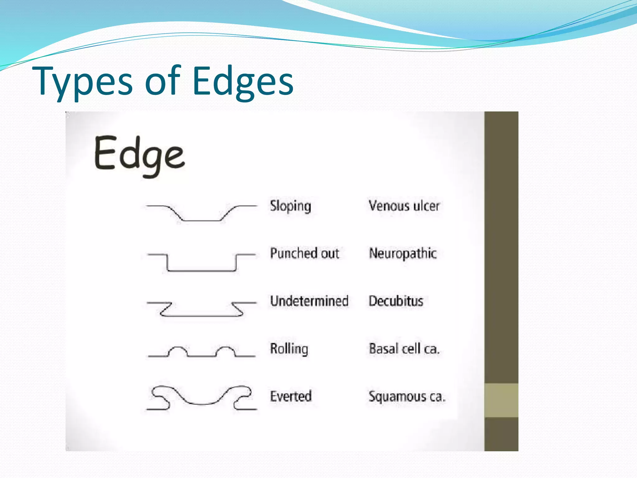 Inspection of ulcer | PPTX