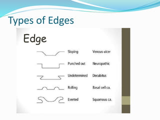 Inspection of ulcer | PPTX