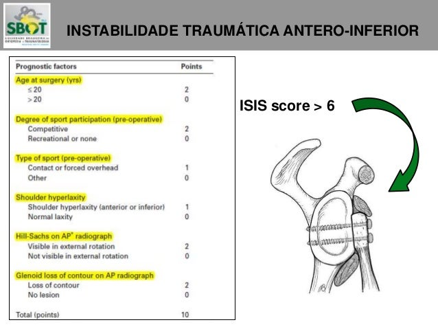 Instabilidade glenoumeral - aula Ortocurso 2016