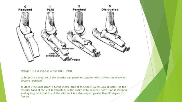 Instability around elbow -1st part