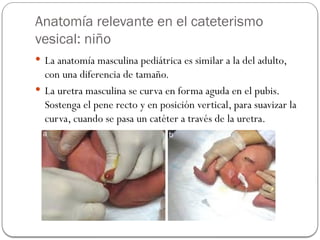 Instalación De Sonda Vesical En Pediatría Pptx