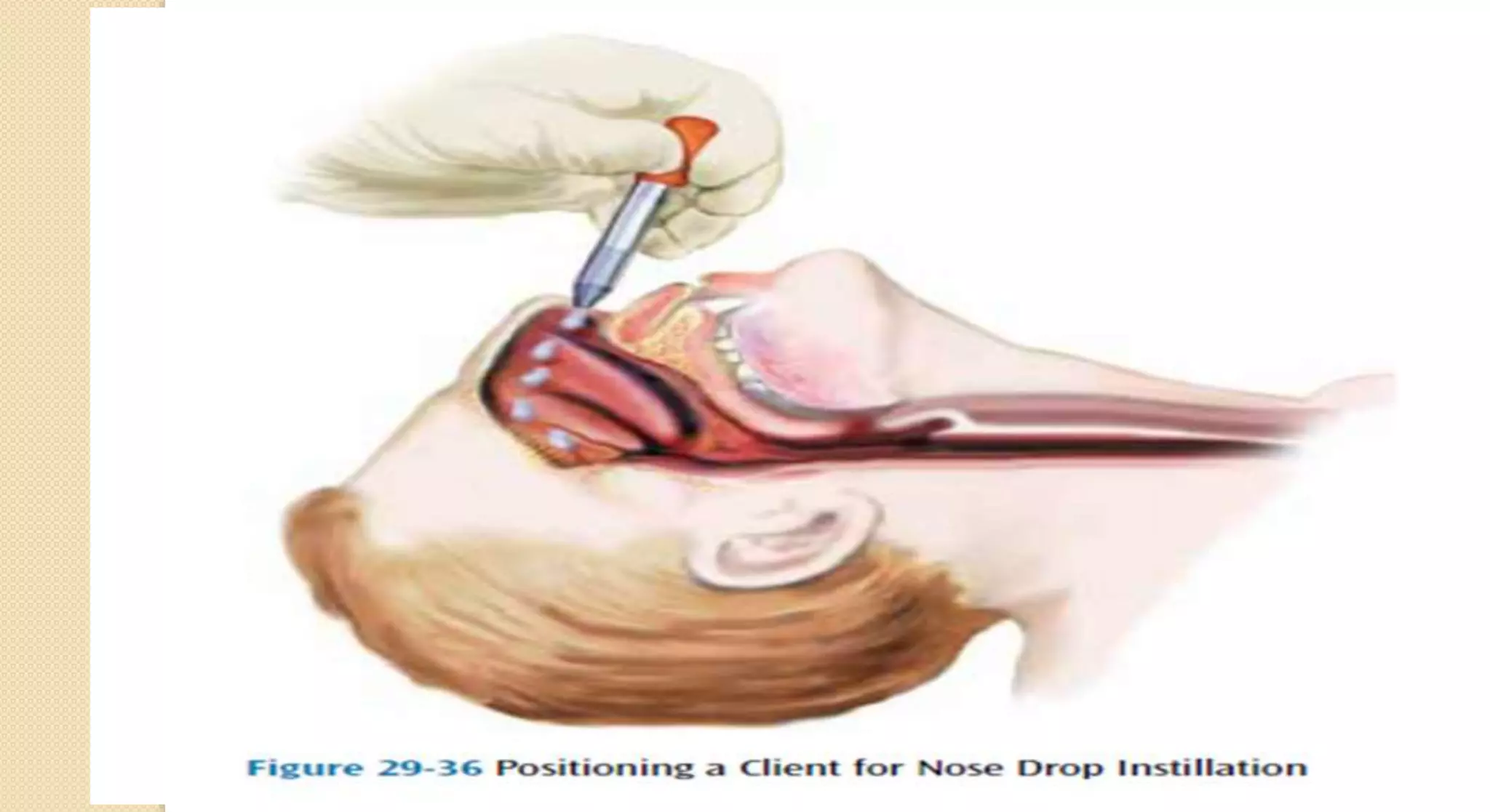 Installing nasal drops.pptx
