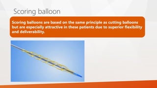 In stent retenosis treatment | PPTX
