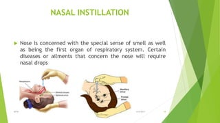 Instillation of Drug | PPTX