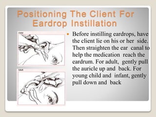 Instillation of medication | PPTX