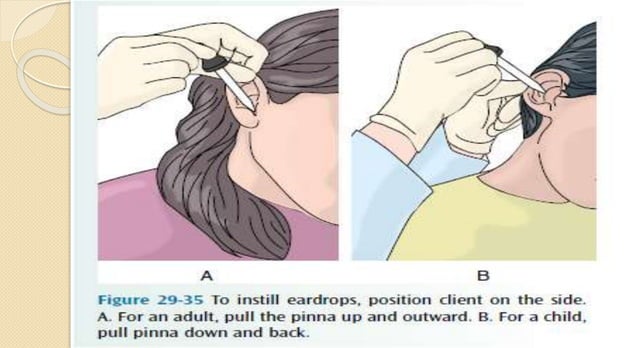 Instilling ear medication.pptx | Ear, Nose and Throat Conditions ...