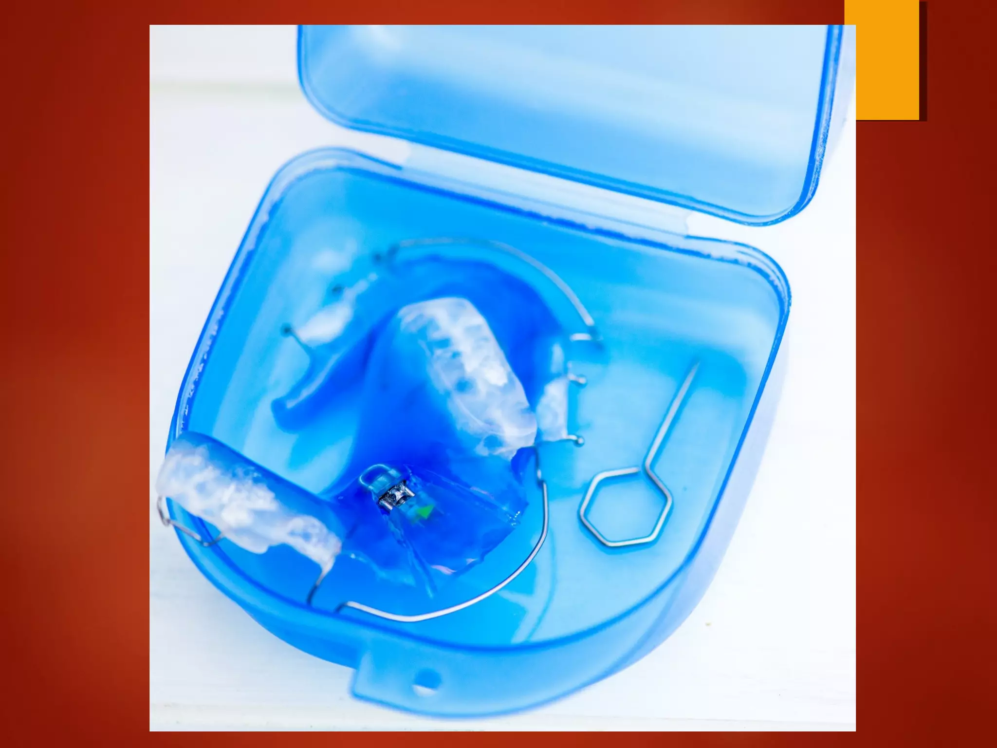 Instruction to the patient after denture delivery | PPT