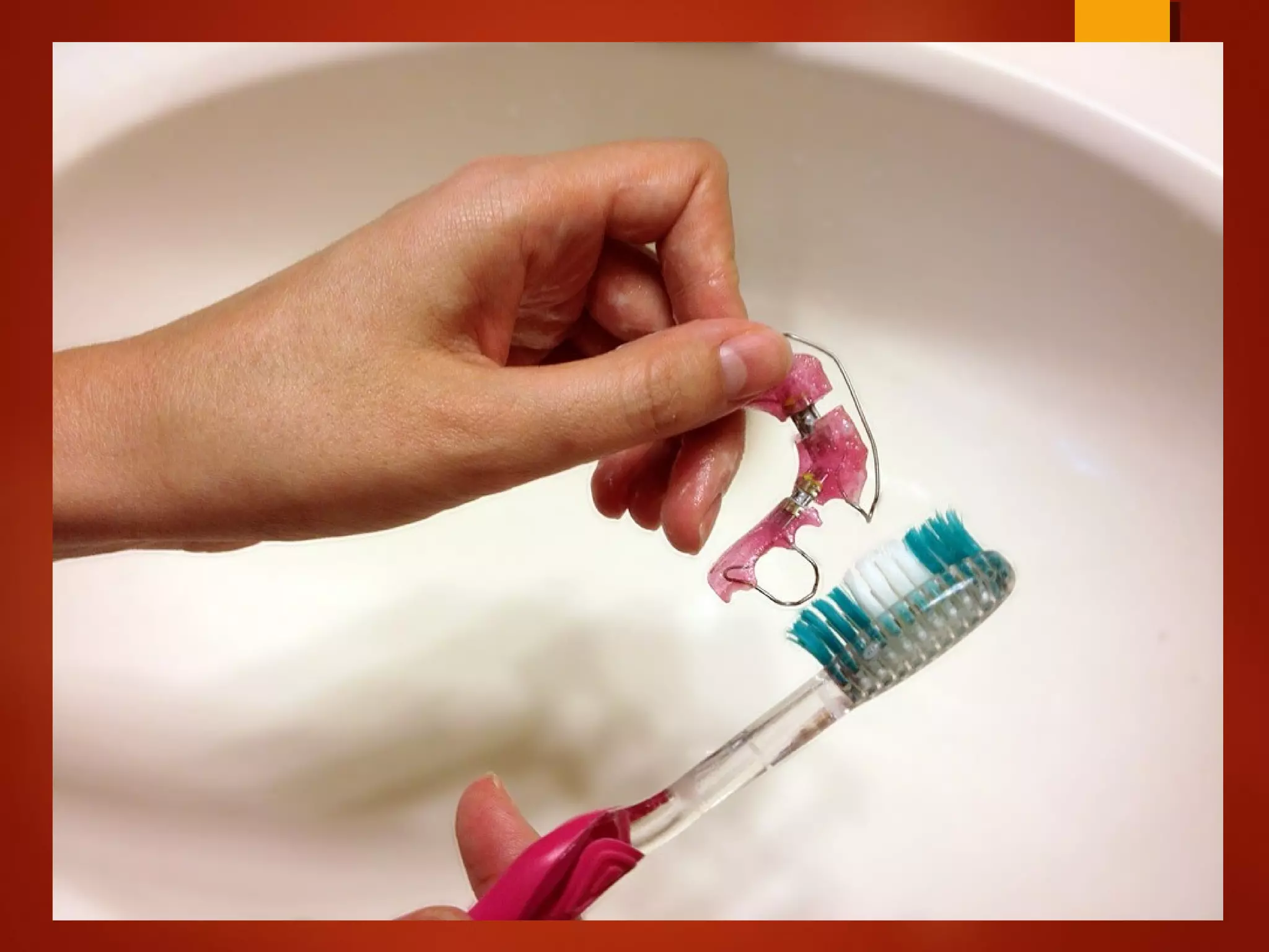 Instruction to the patient after denture delivery | PPT