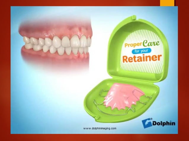 Instruction to the patient after denture delivery | PPT