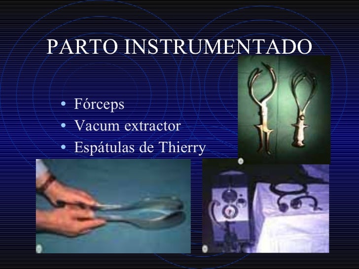PARTO INSTRUMENTADO - CESAREA