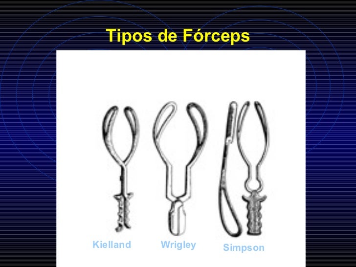 Parto vaginal instrumental