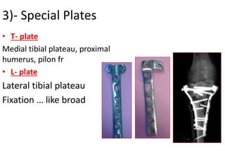 Orthopedic surgery INSTRUMENTS (short overview).pptx