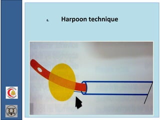 Instruments in Urology | PPT