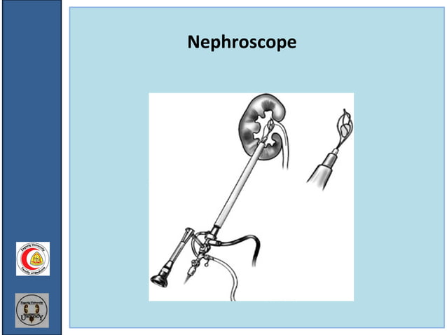 Instruments in Urology | PPT | First Aid | Injuries