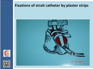 Instruments in Urology | PPT