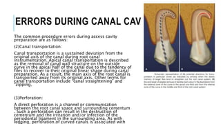Endo Instruments | PPT