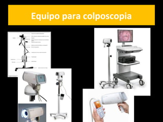 Instrumentacion en colposcopia | PPT