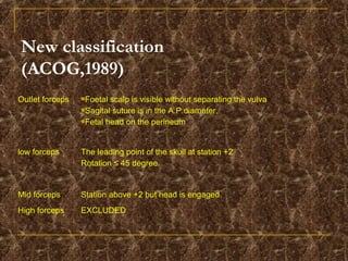 Instrumental delivery | PPT