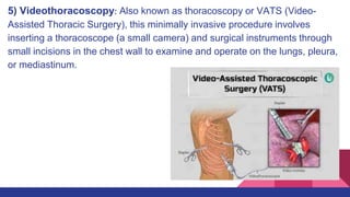 Instrumental_Diagnostic_Studies_Of_Thoracic_Surgery_Operations_on.pptx ...
