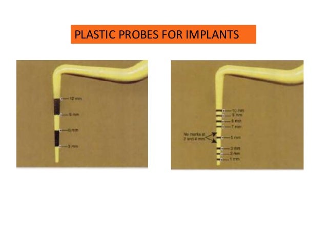Periodontal Instrumentation