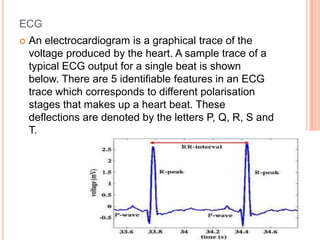 Instrumentation amplifier in ECG | PPTX