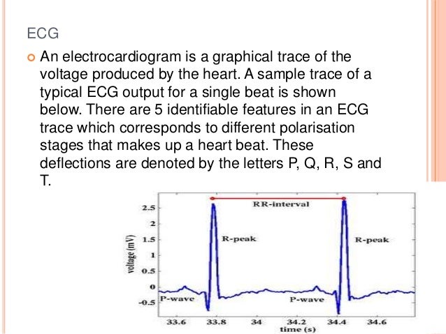 Instrumentation amplifier in ECG