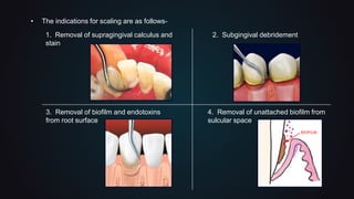 Instrumentation and Oral Prophylaxis | PPTX