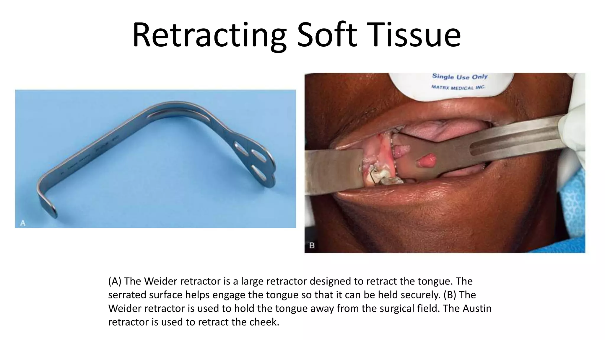 Instruments for oral surgery | PPT