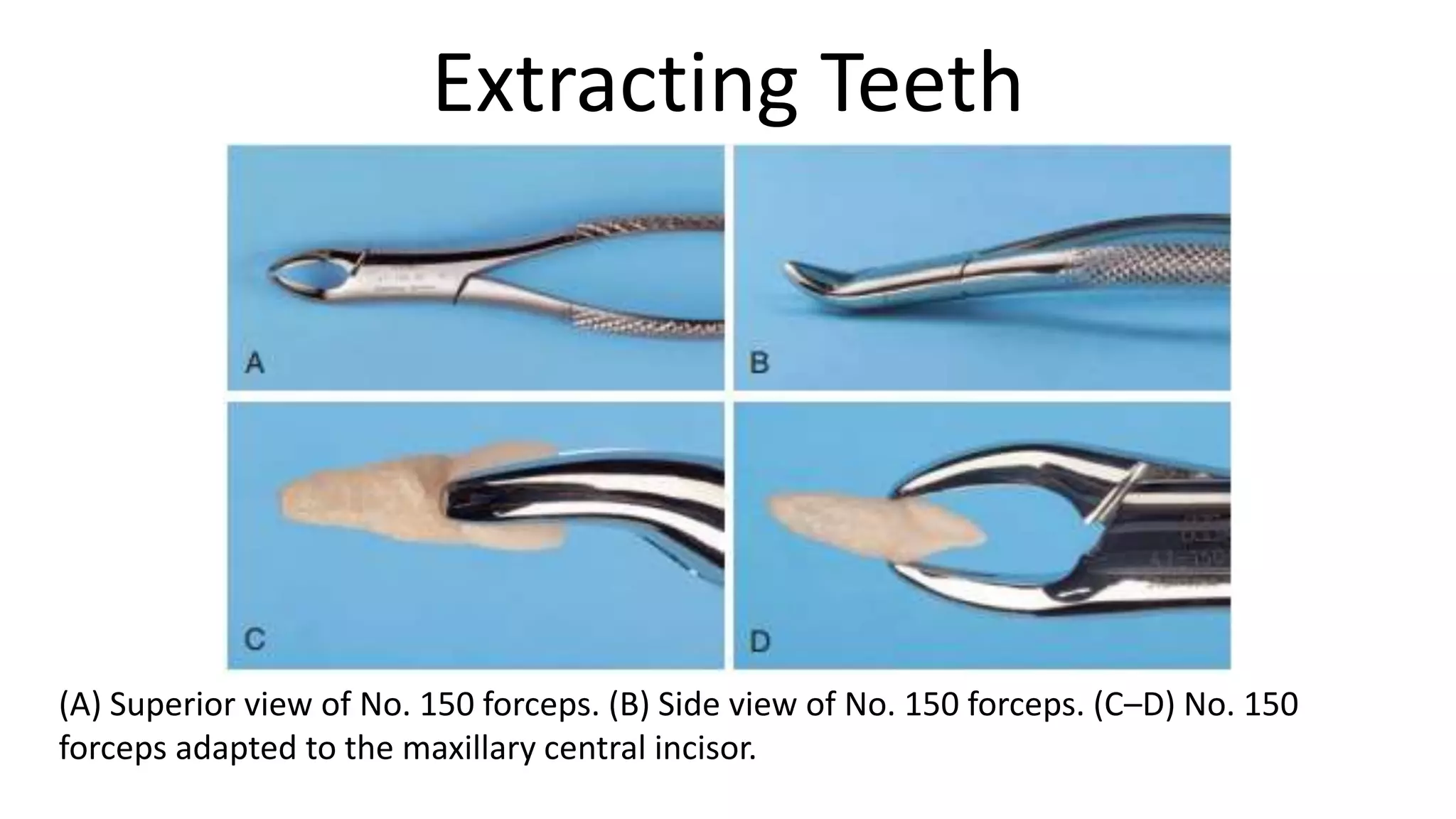 Instruments for oral surgery | PPT