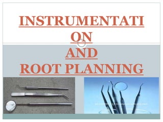 Instrumentation for scaling and root planing | PPT