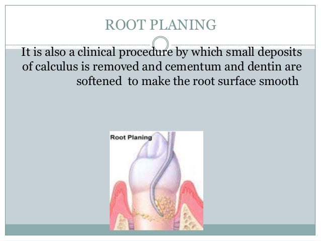 Instrumentation for scaling and root planing