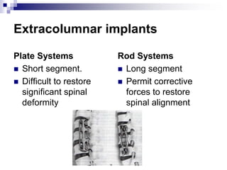 Instrumentation for thoracolumbar fracture_.ppt
