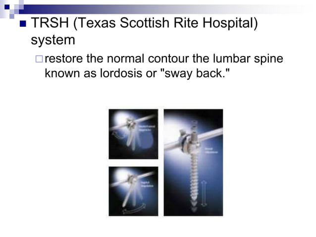 Instrumentation for thoracolumbar fracture_.ppt
