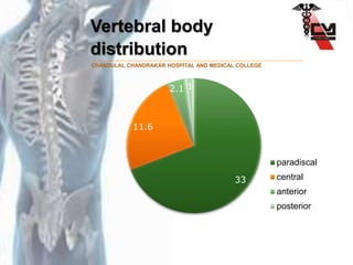 Instrumentation in cases of tuberculosis of spine | PPTX