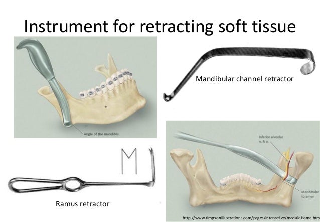 Instrument in oral surgery