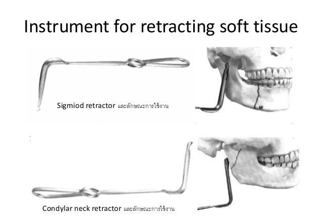 Instrument in oral surgery