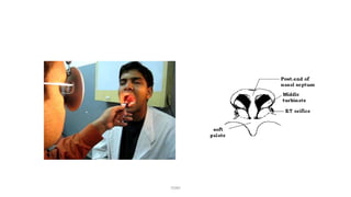 Instruments ent ppt with uses otorhinolaryngology ent | PPTX