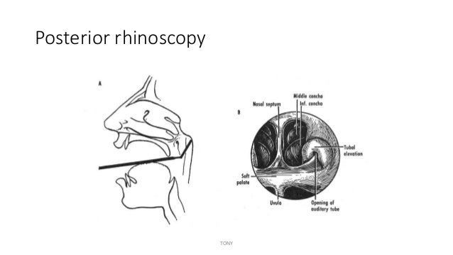 Instruments ent ppt with uses otorhinolaryngology ent