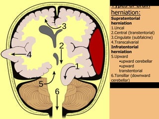 instruments.pptx ghvvyvyvyvyvyvyvyvvyvyvvyv | PPT