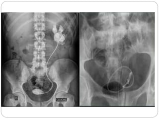 Urological instruments(uses,indication&contraindication).pptx